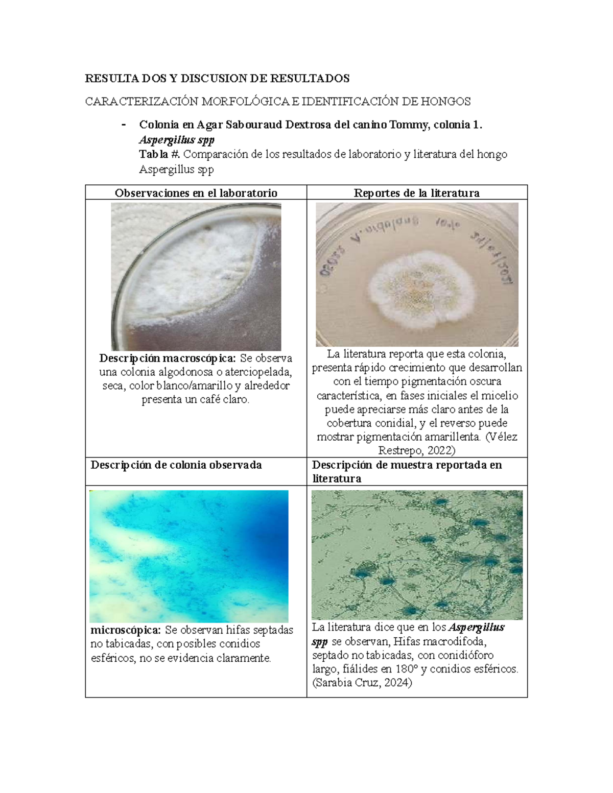 RESULTADOS Y DISCUSIÓN DE HONGOS ASPERGILLUS spp. EN AGAR SABOURAUD ...