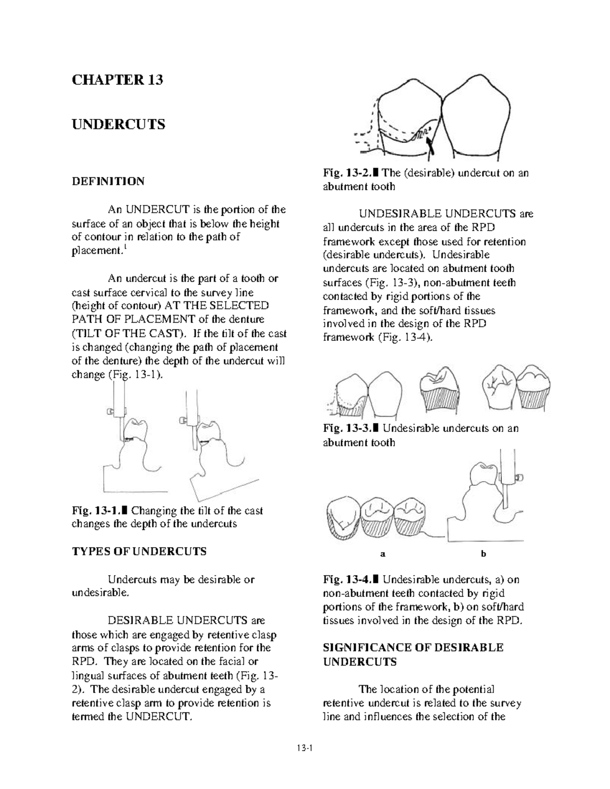 Chapter 13: Understanding Undercuts in Prosthodontics - Studocu