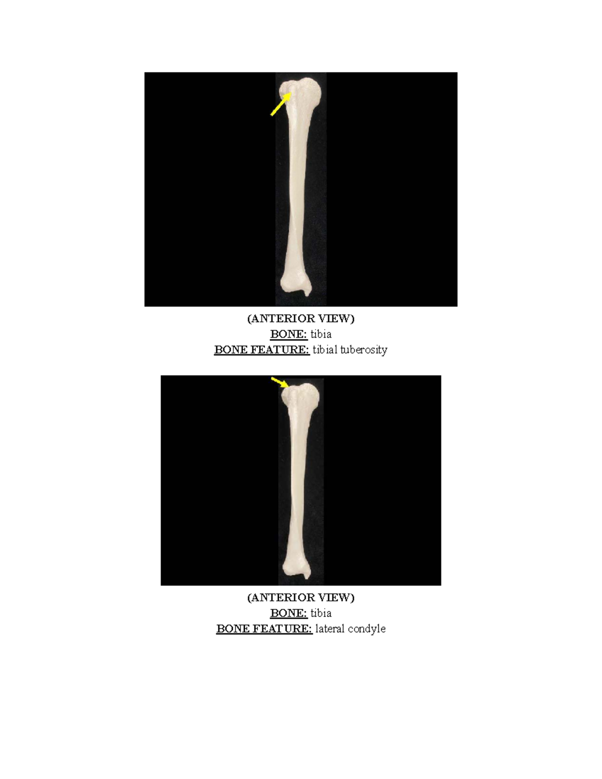 Module 6 - Exercise 15: Appendicular Skeleton - Lower Limb Bone ...