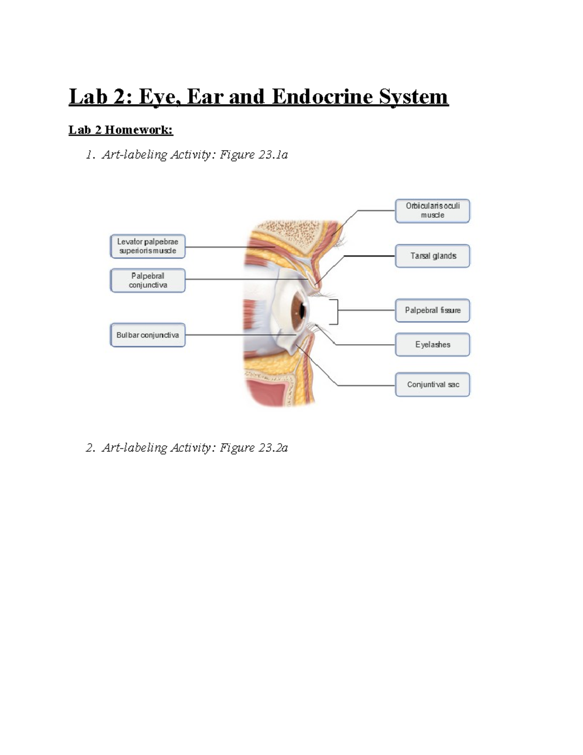 Lab 2: Eye, Ear, and Endocrine System Homework and Activities - Studocu