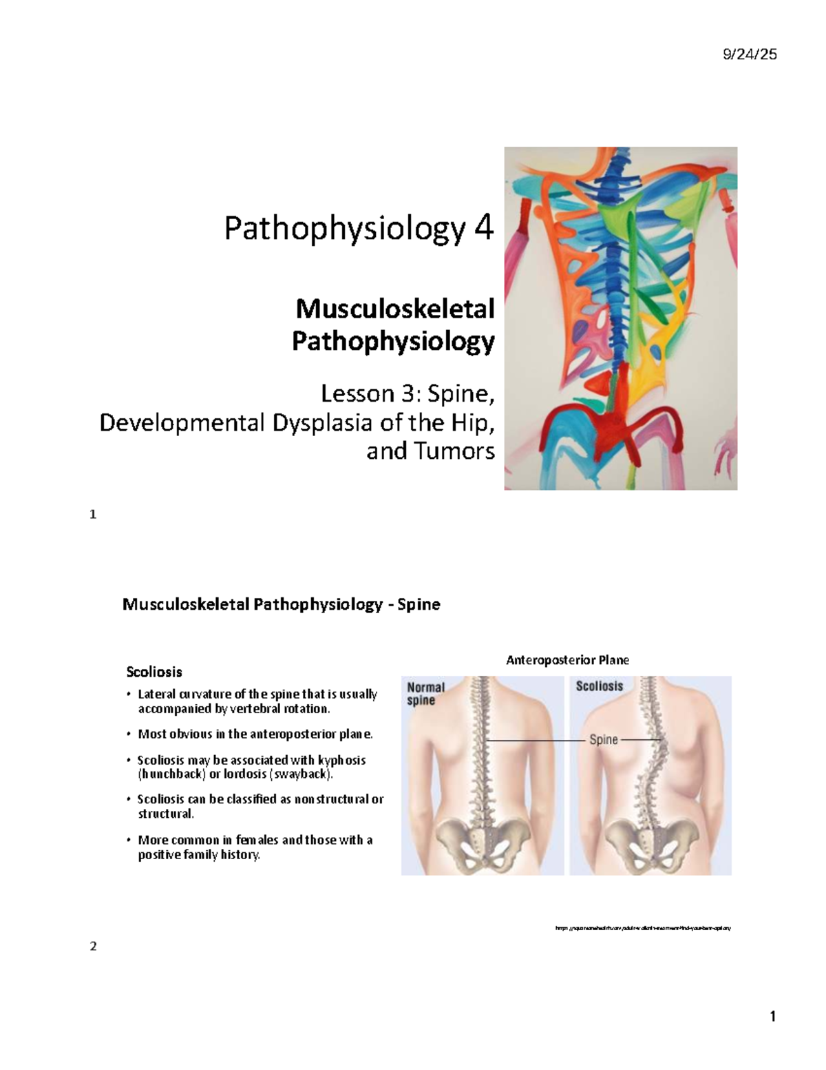 Musculoskeletal Pathophysiology 4: Spine & Hip Disorders Lesson 3 - Studocu