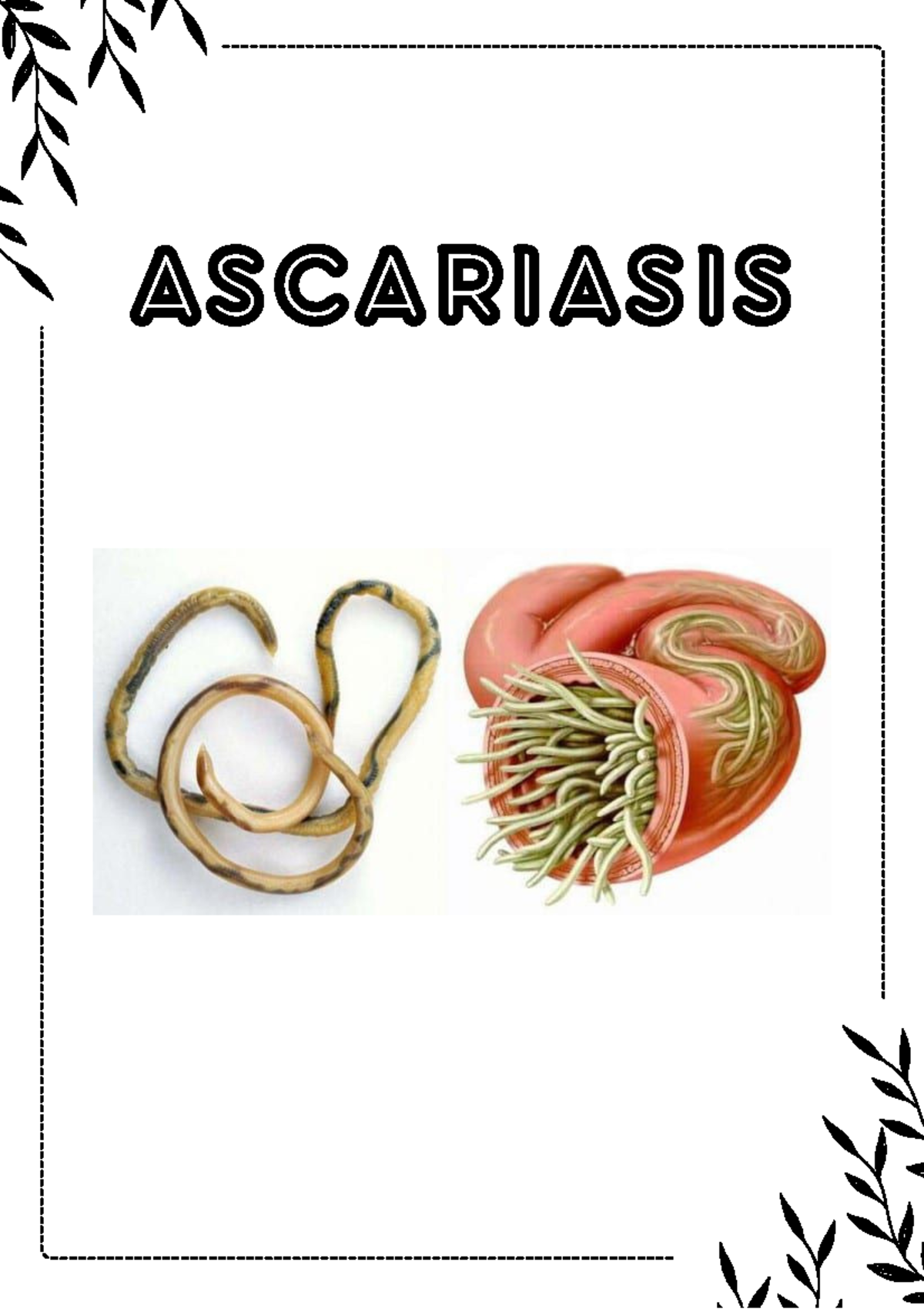 Ascariasis: Sintomas, Causas y Prevención en Microbiología 101 - Studocu