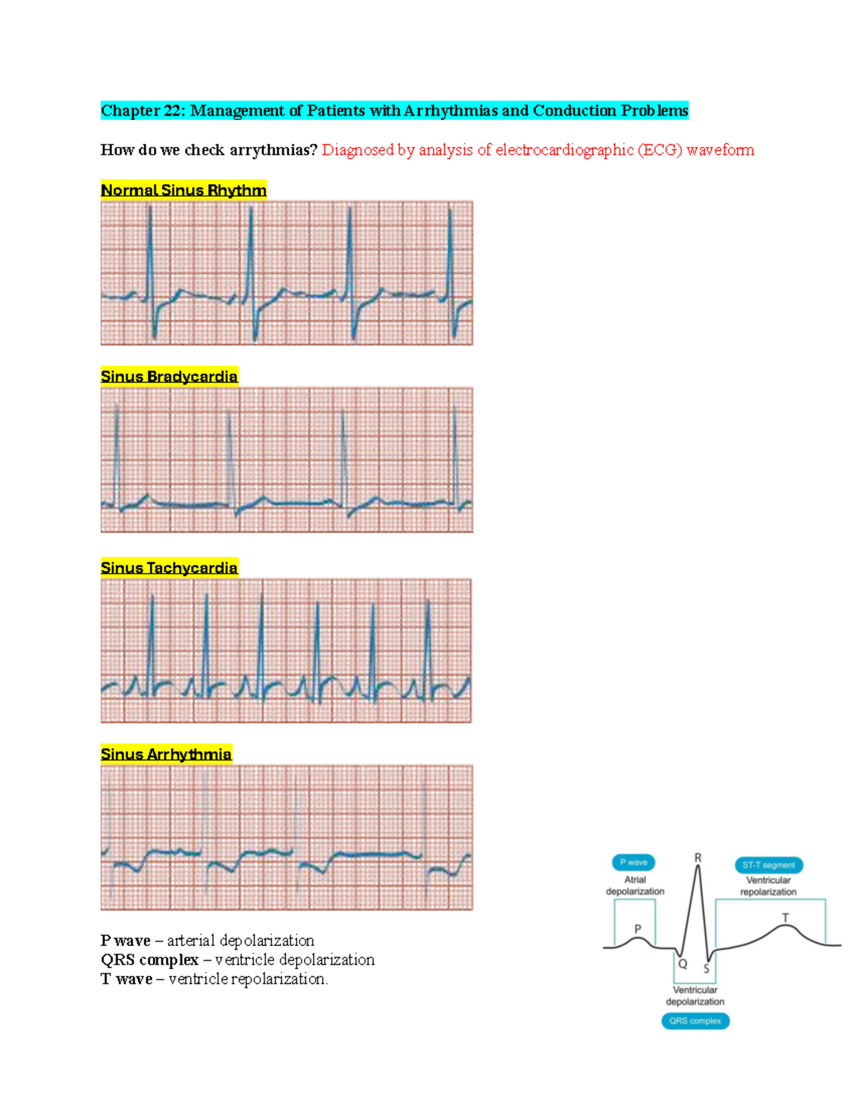 Chapter 22: Management of Arrhythmias and Conduction Problems in ...