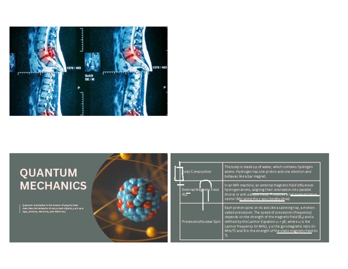 General Overview of Classical & Quantum Mechanics in MRI (MAGNETIC ...