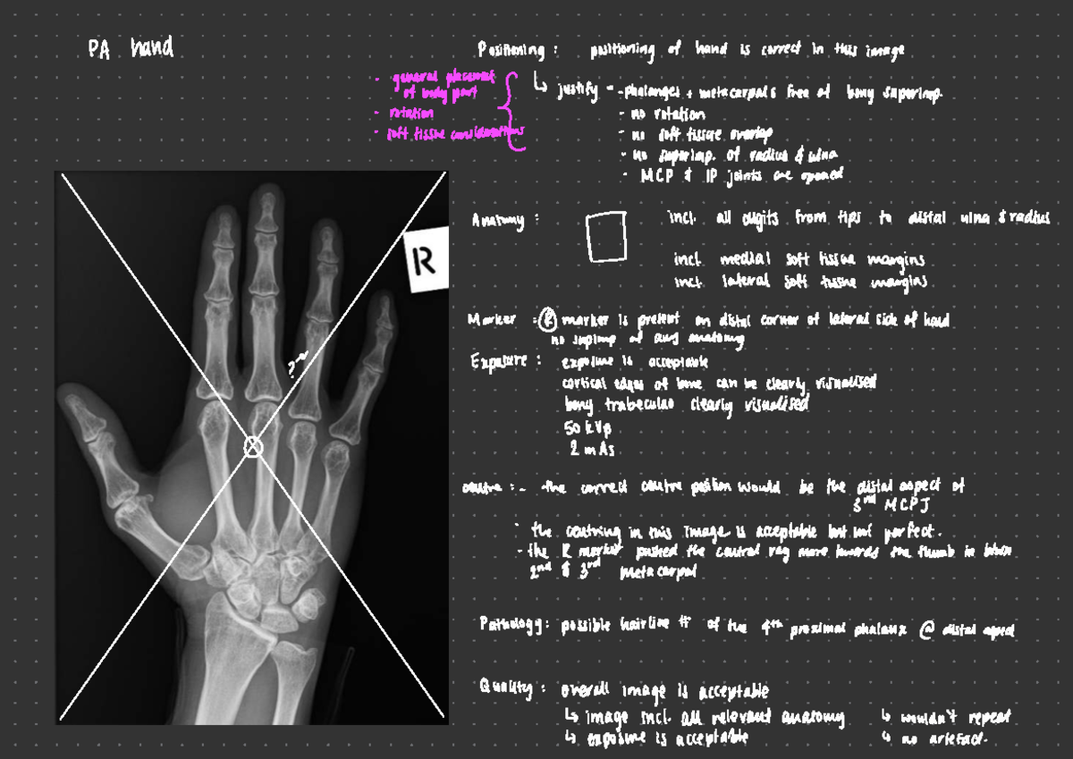 PA Hand Positioning and Soft Tissue Considerations: Critiques - Studocu