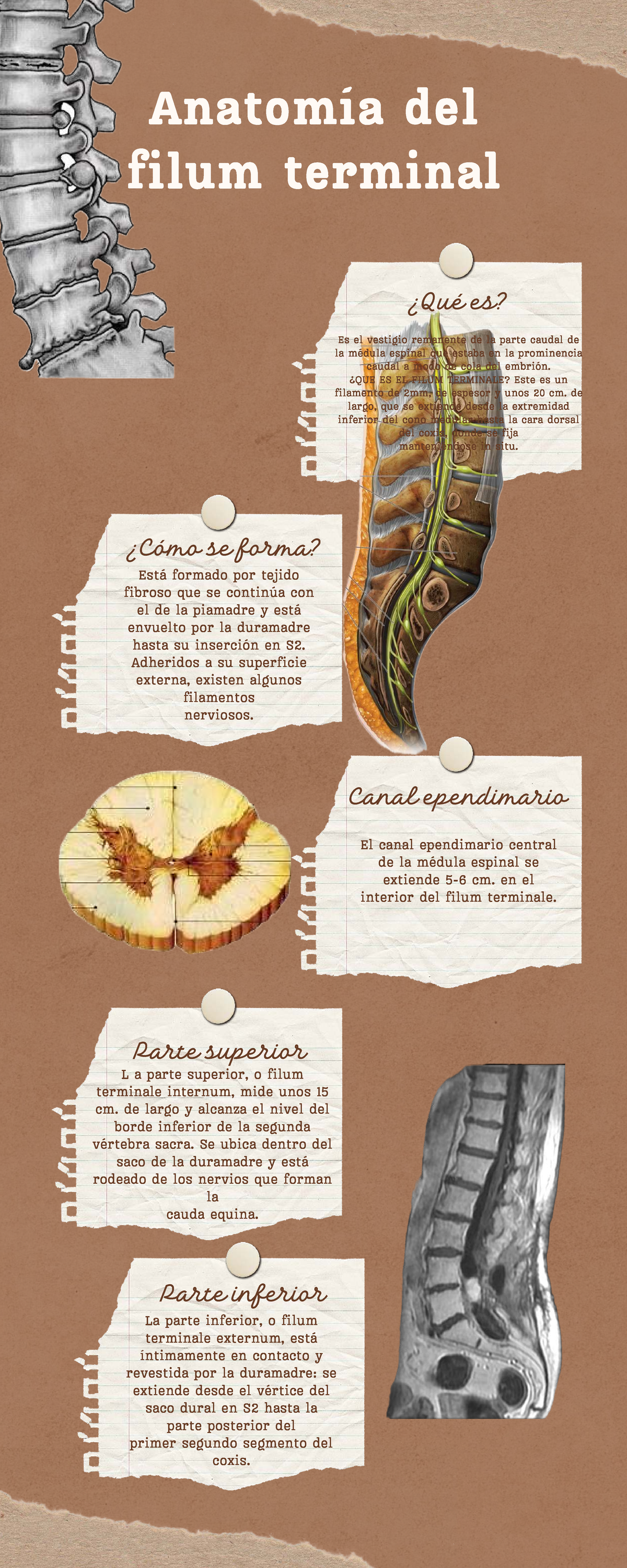 Infografía sobre el Filum Terminale: Anatomía y Función - Studocu