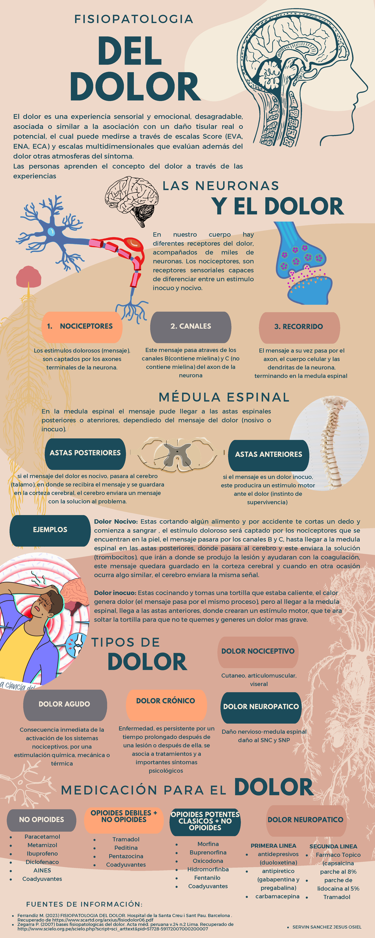 Infografia fisiopatologia del dolor - 2. CANALES 3. RECORRIDO EJEMPLOS ...