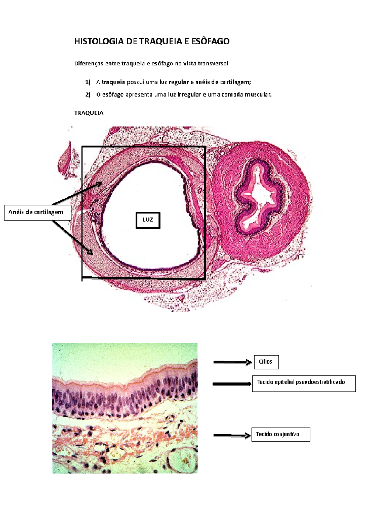 Diagrama De Esofago E Traqueia Sistema Respiratório – Histologia