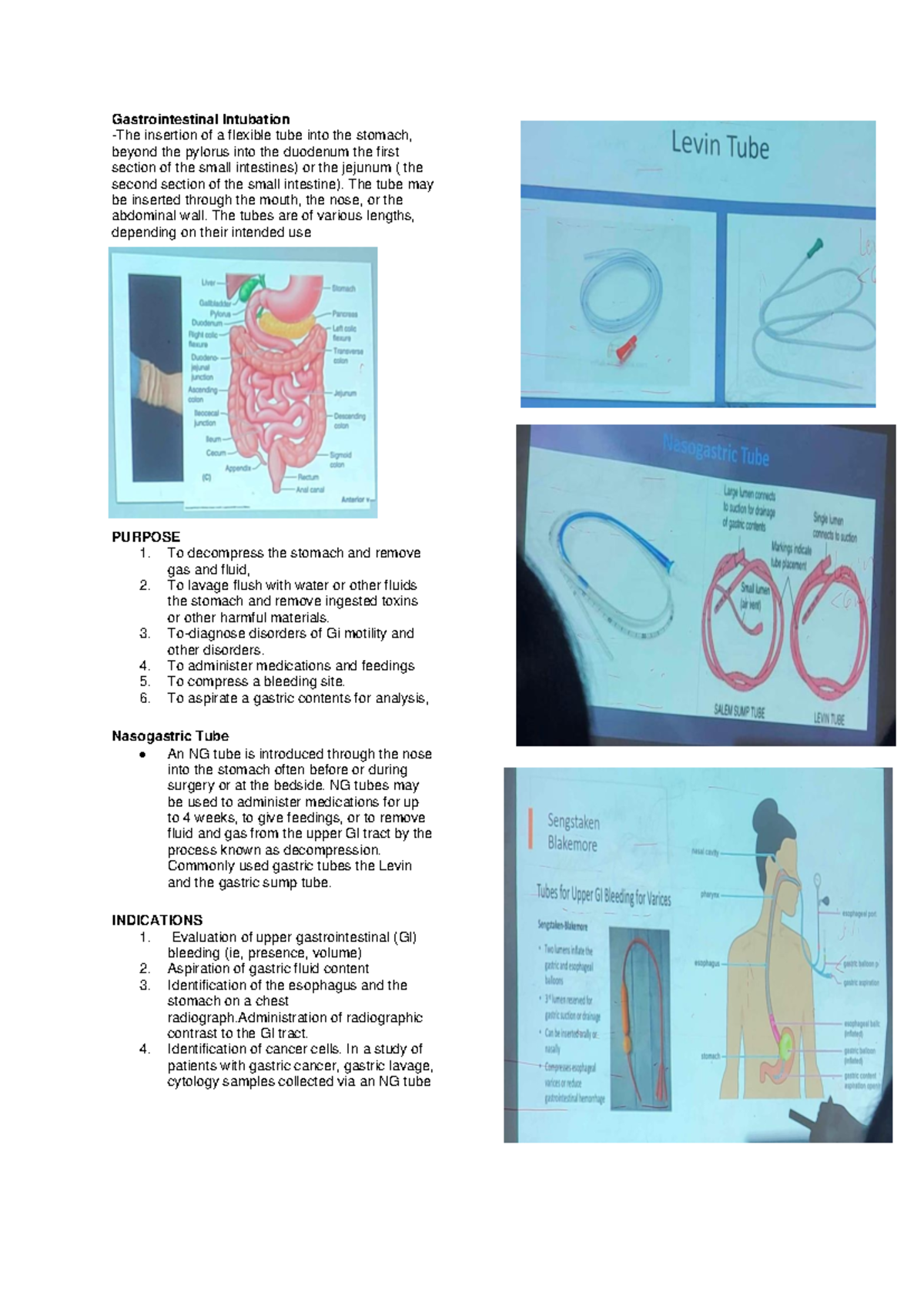 NGT-TUBE-GI - Comprehensive Review on Gastrointestinal Intubation - Studocu