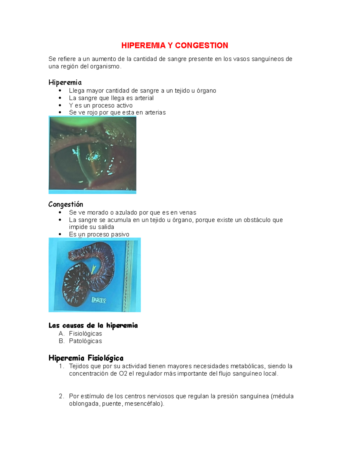 Hiperemia y Congestión: Conceptos Vitales en Circulación Sanguínea ...