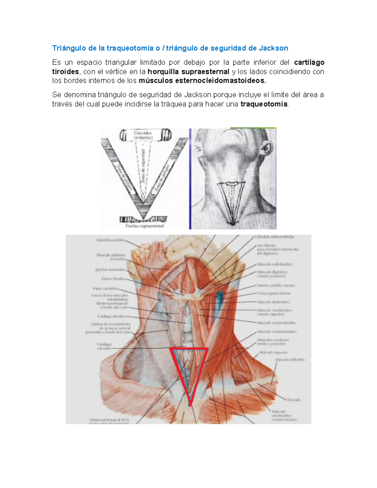 Triángulo de la Traqueotomía: Seguridad de Jackson y Procedimiento ...