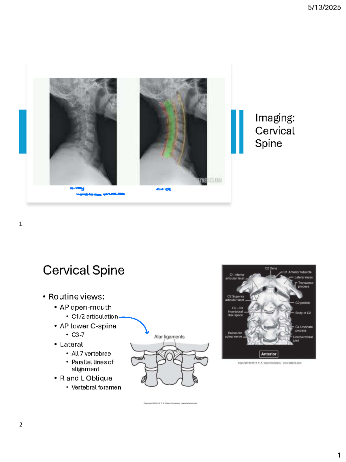 Cervical Spine Imaging & Trauma Management: Key Guidelines & Rules ...