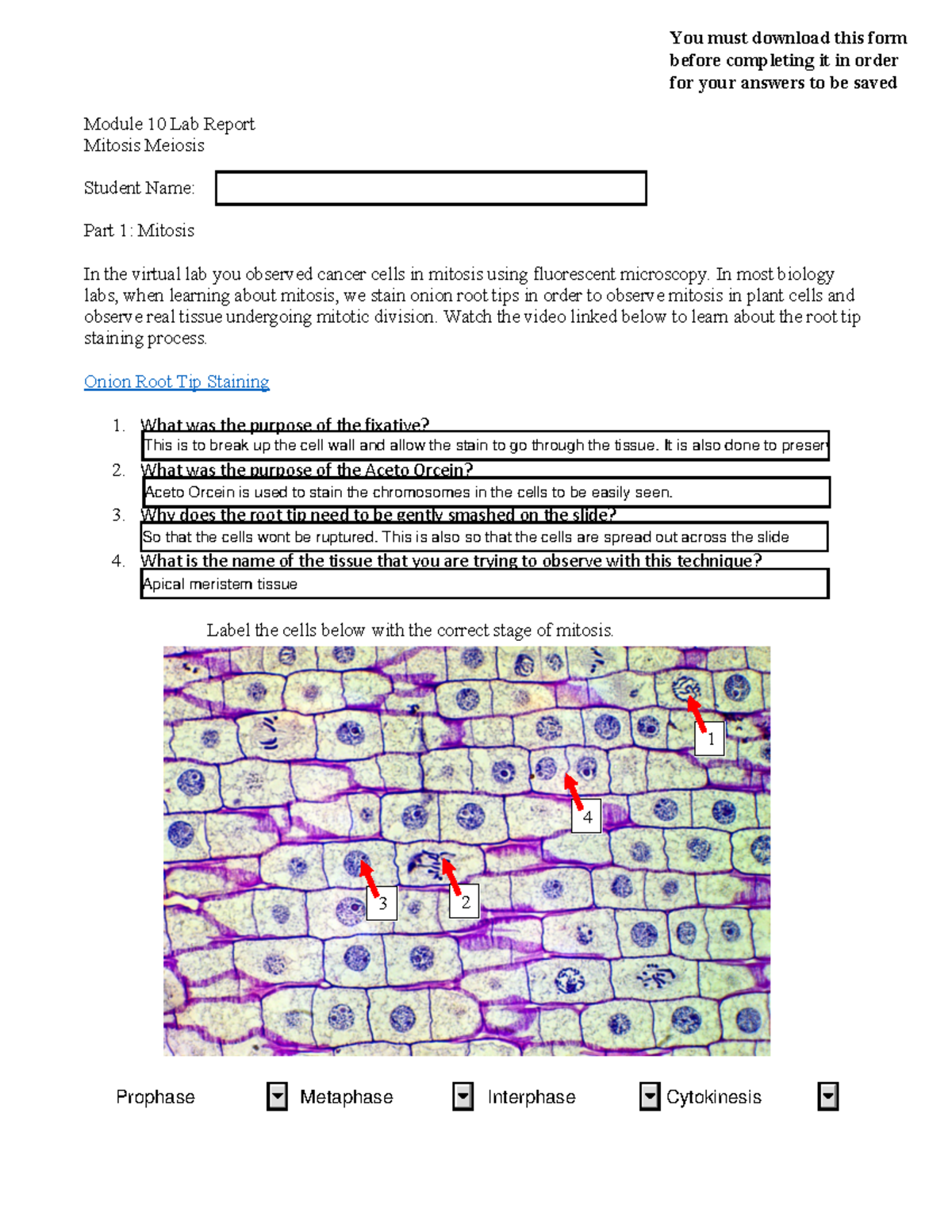 Module 10 Lab Report - This lab is on Mitosis and meiosis. it shows the different stages of ...