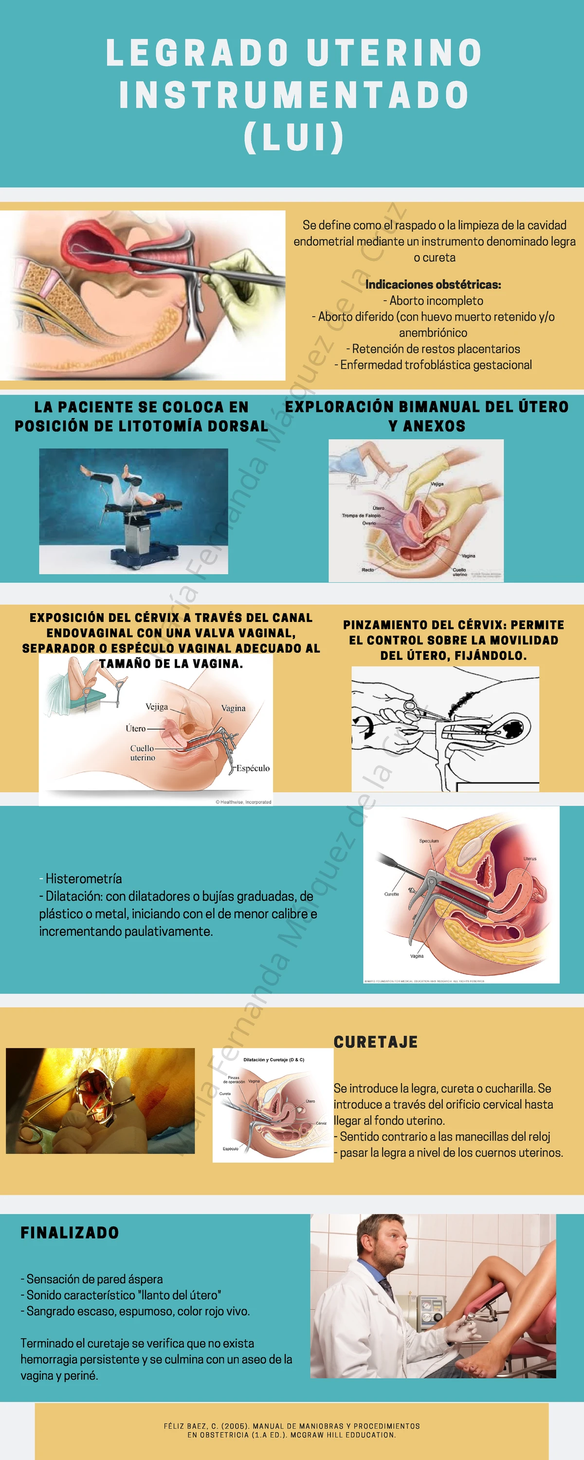 Planos de Hodge: Guía para el Parto Vaginal en Obstetricia - Studocu