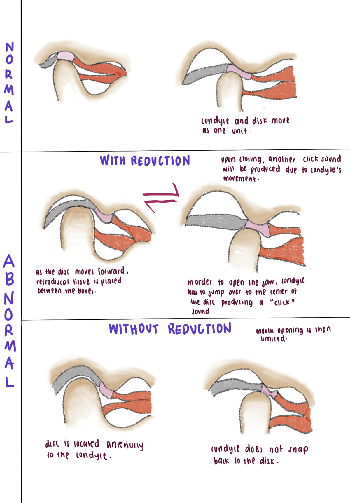 TMJ Notes - Normal vs. Abnormal Functions of TMJ Mechanics - Studocu