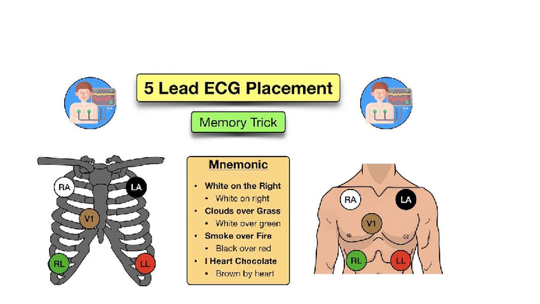 12 Lead ECG Placement Mnemonic Tricks for EKGs - Studocu