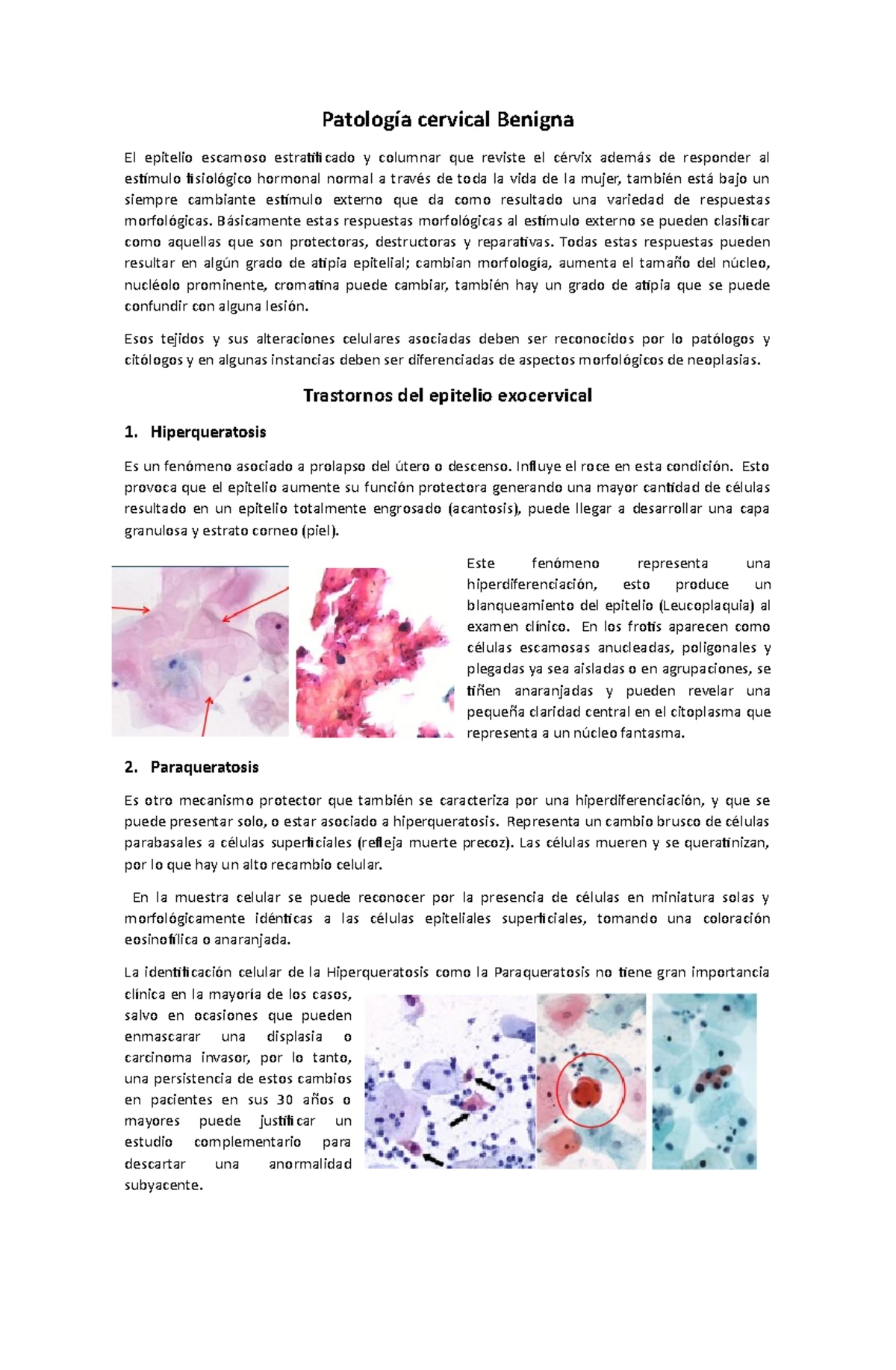 LSIL - Ascus - HSIL - Citologia Inflamatória (ASCUS, LSIL, HSIL ...