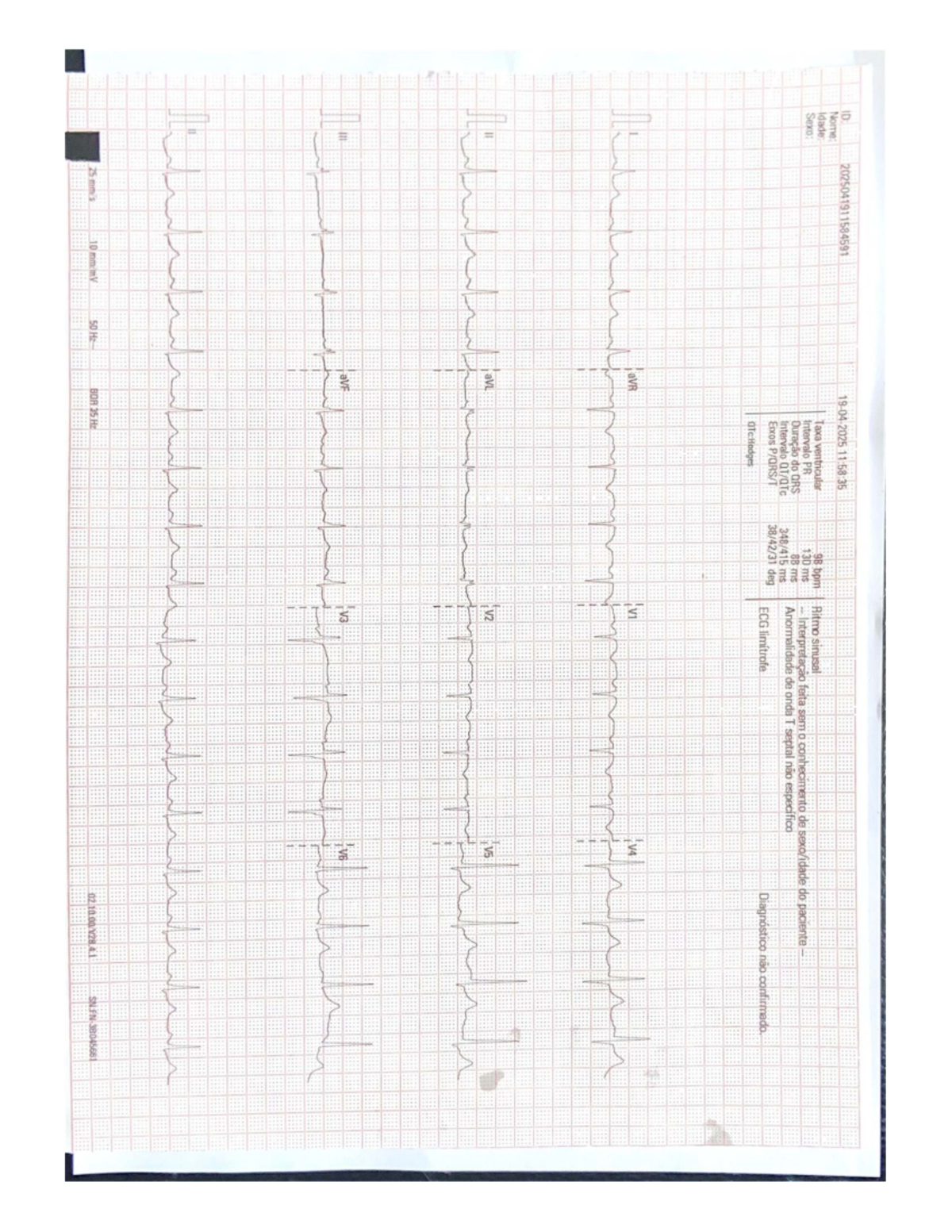 ECG Analysis - Stefany - USP - Diagnostic Insights - Studocu