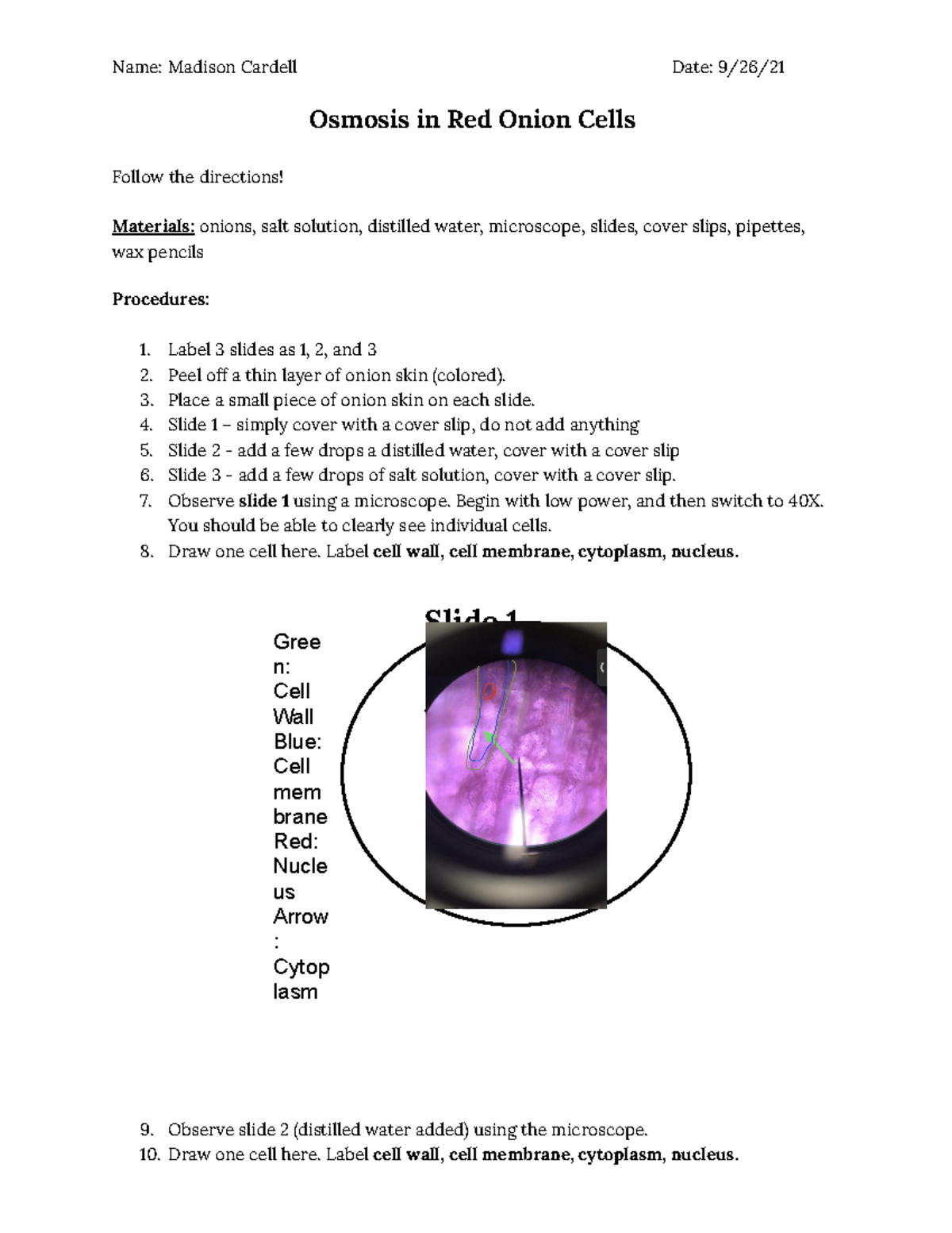 Osmosis in Red Onion Cells - Osmosis in Red Onion Cells Follow the ...