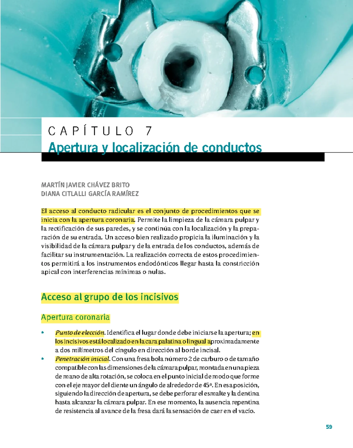 Materiales y Técnicas de Obturación en Endodoncia II (Ciencias de la ...