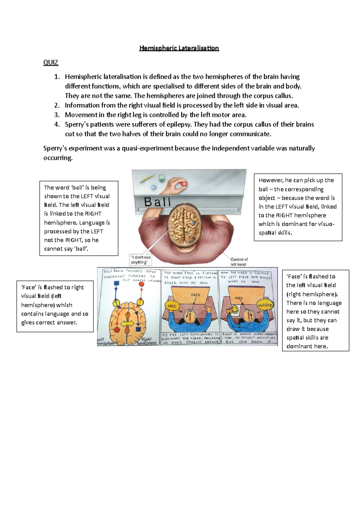Hemispheric Lateralisation Quiz A03: Functions and Split Brain Insights ...