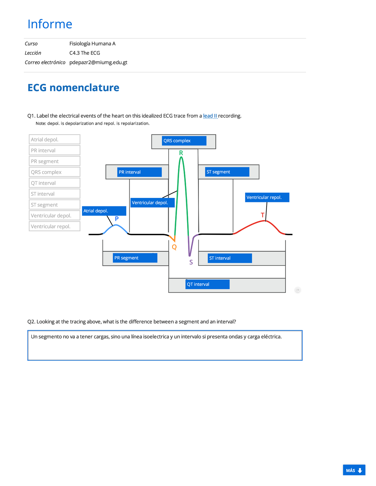 C4.3 The ECG report - ………..:::.::::::::: - Informe Curso Fisiología ...