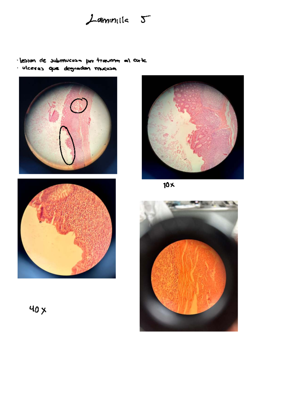 Laminilla Lesion de Ulceras Submucosa - Lab Pato (Enfermedad de EPOT ...