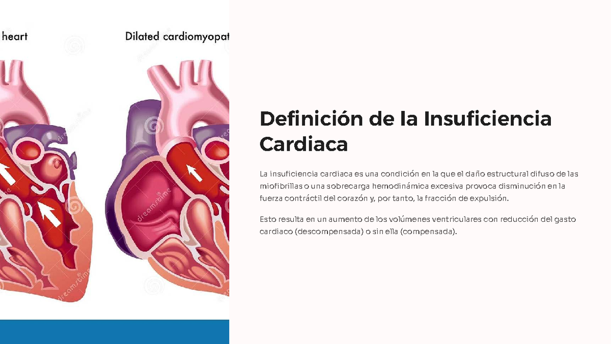 Definición de la Insuficiencia Cardiaca: Mecanismos y Clasificación ...