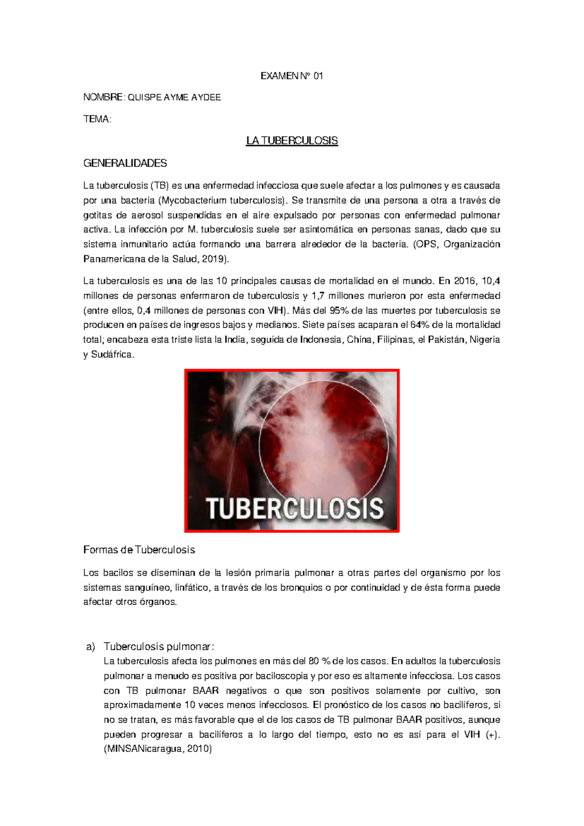 Examen N°01: Estudio Completo sobre la Tuberculosis y sus Tipos - Studocu