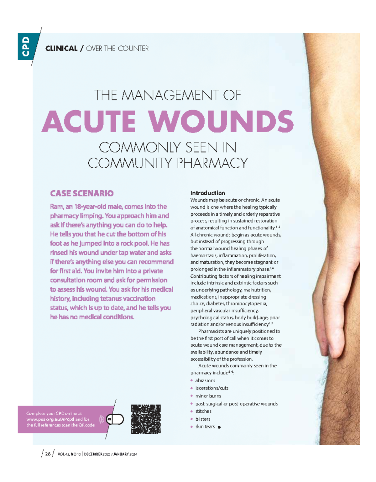 Management of Acute Wounds in Community Pharmacy: A CPD Overview - Studocu