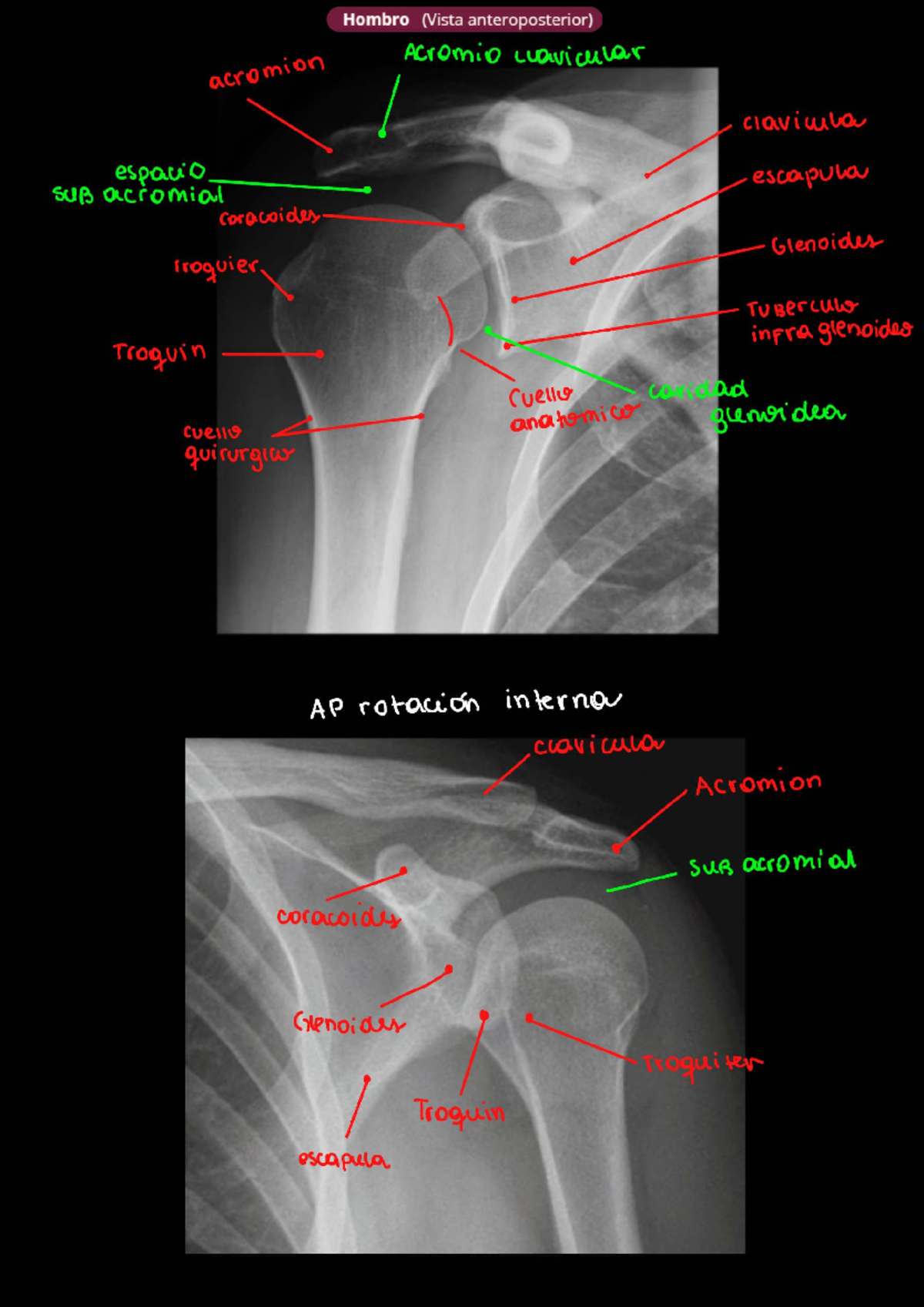 Radiodiagnóstico 1: Hombro y Anatomía Clavicular AP - Studocu