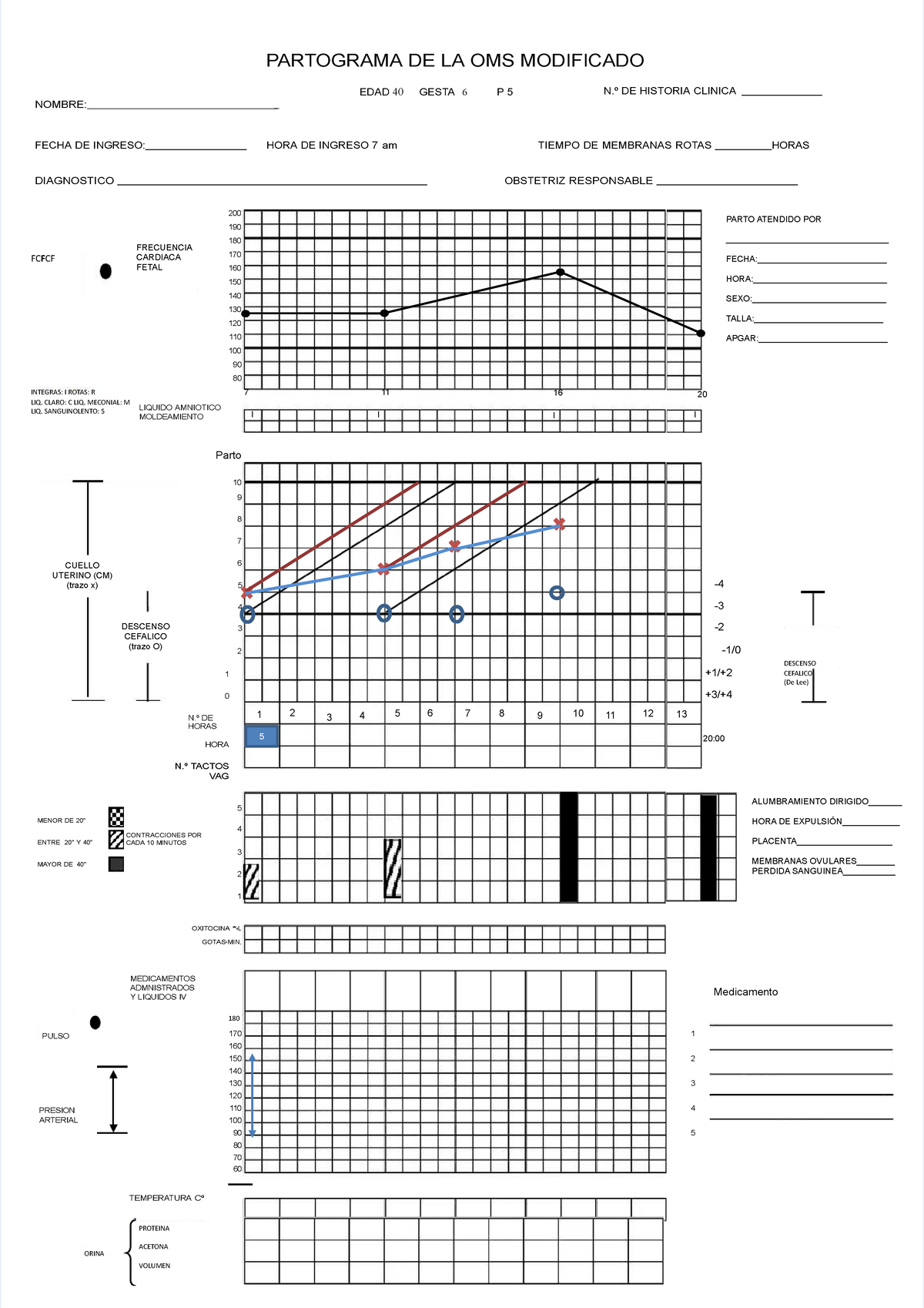 Partograma caso 3 - 180 DILATACION CUELLO UTERINO(cm) (trazo X) (trazo ...