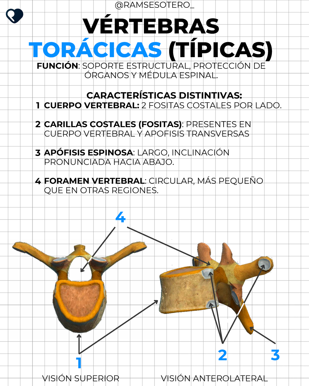 VÉRTEBRAS TORÁCICAS (TÍPICAS) - 1 VÉRTEBRAS TORÁCICAS (TÍPICAS) FUNCIÓN ...