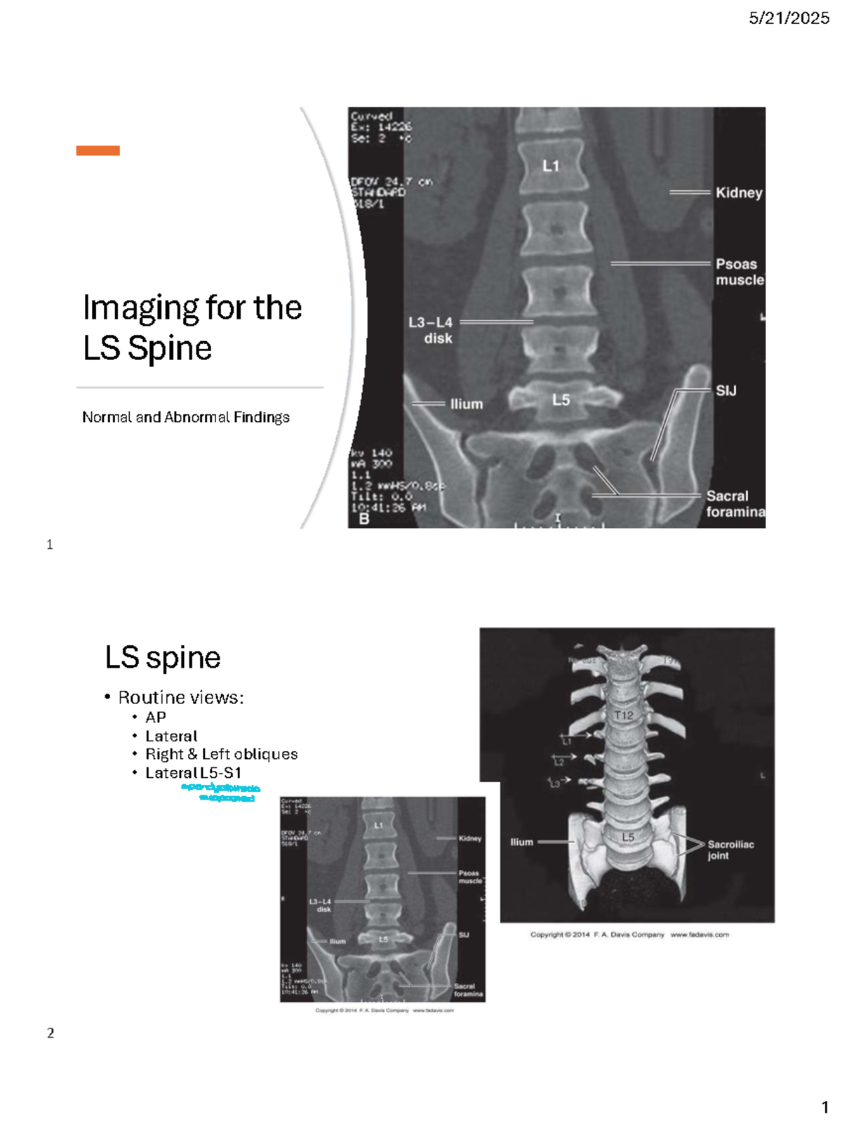 Imaging Techniques for LS Spine: Normal & Abnormal Findings - Studocu
