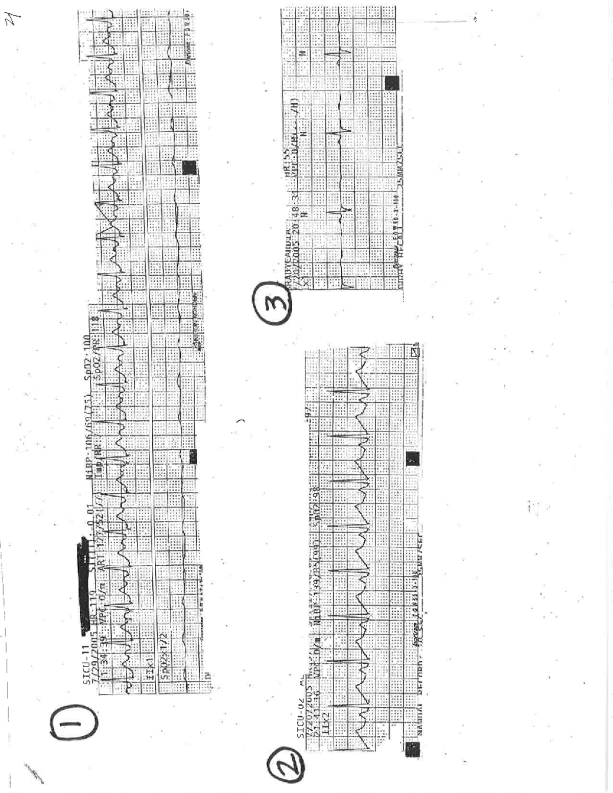 Arrhythmia Strip Homework 1: Analysis & Data Interpretation - Studocu