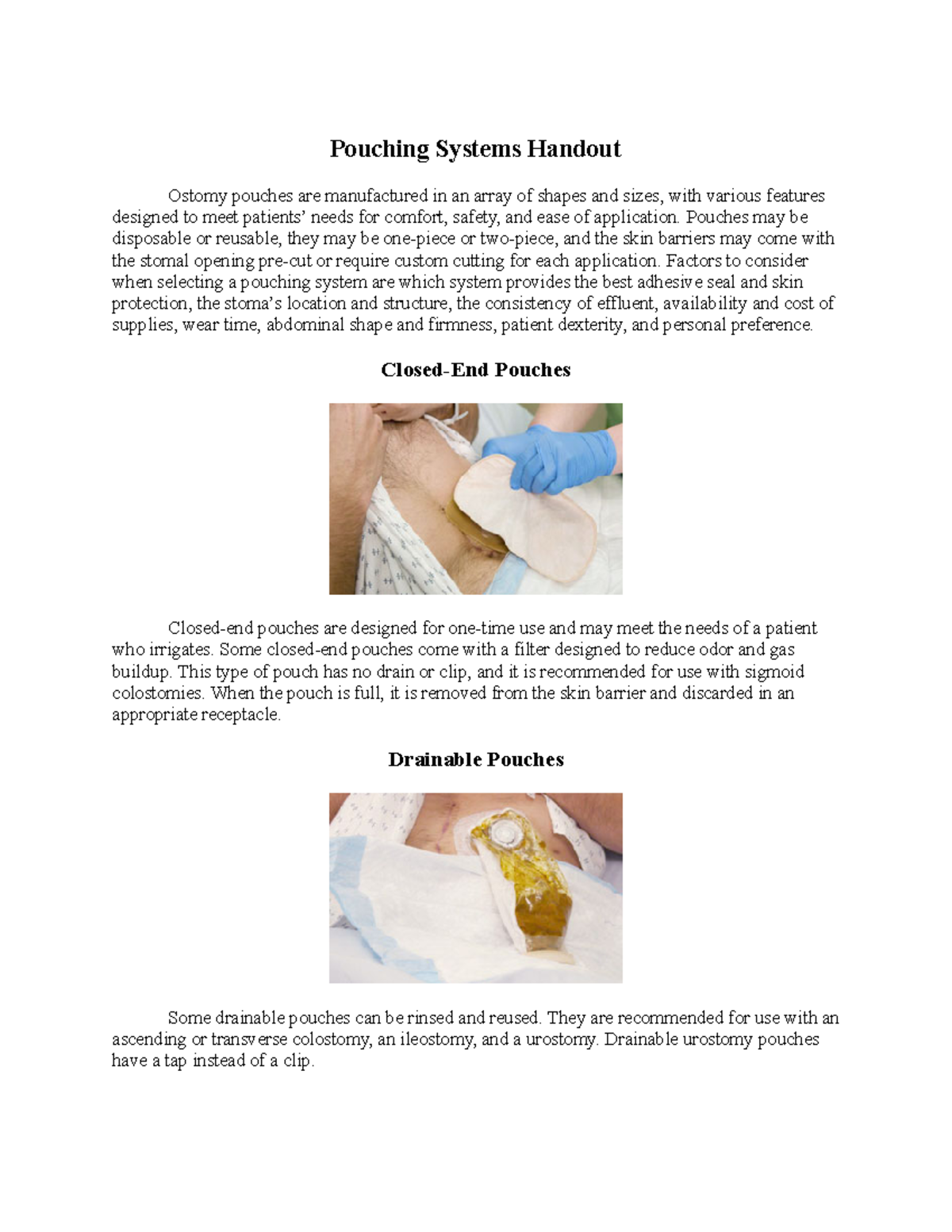 Pouching Systems: Types, Features, and Care Guide for Ostomy Use - Studocu