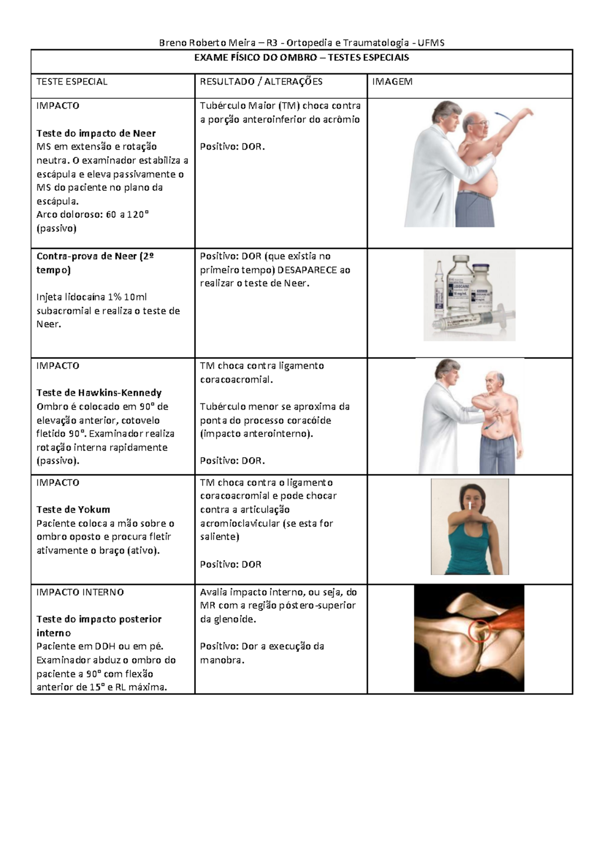 Testes Especiais no Exame Físico do Ombro: Método e Resultados - Studocu