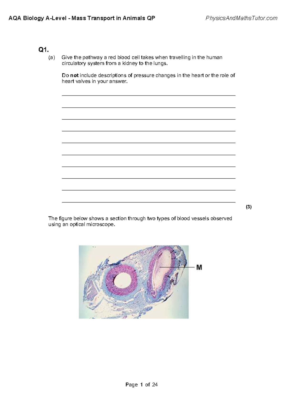 AQA Biology Mass Transport in Animals QP - Circulatory System Insights ...