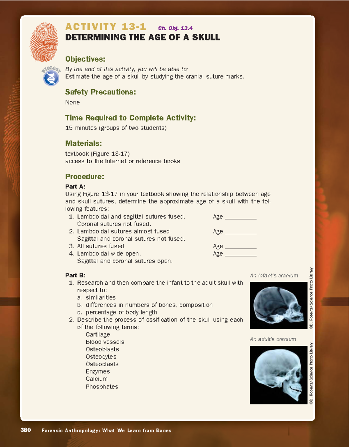 Forensic Anthropology: Activity 13.1 - Determining Skull Age - Studocu