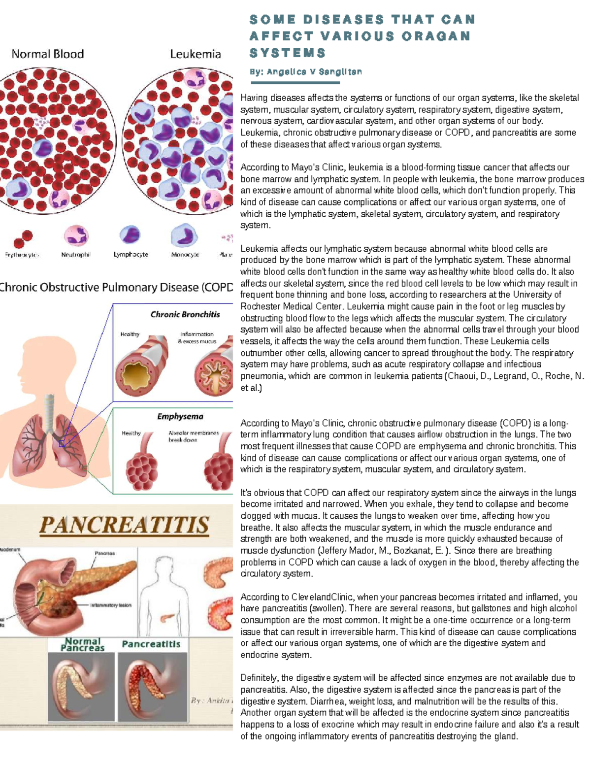 Impact of Diseases on Organ Systems: A Study on Leukemia, COPD, and ...