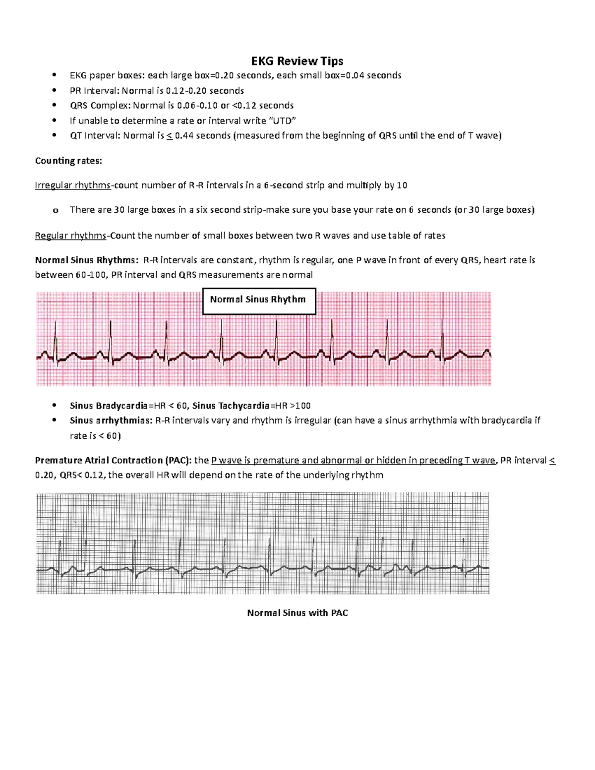 EKG Review Sheet - EKG - EKG Review Tips EKG paper boxes: each large ...