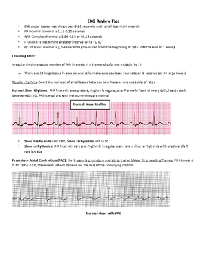 EKG Rhythm Identification Worksheet - Rhythm Identification Worksheet ...