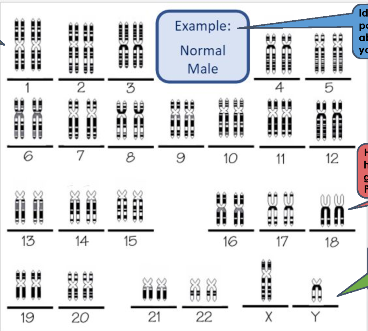 Karyotype Analysis of Down Syndrome - AP-Virtual Study - Studocu