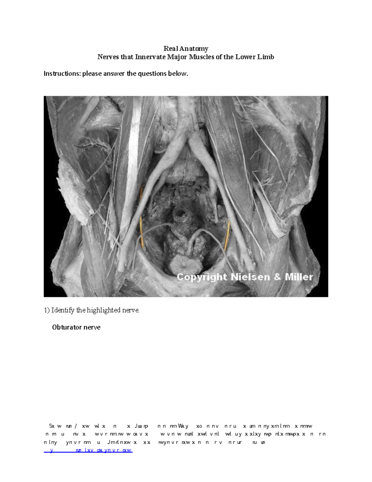 Real Anatomy: 33 Nerves Innervating Major Lower Limb Muscles Worksheet ...