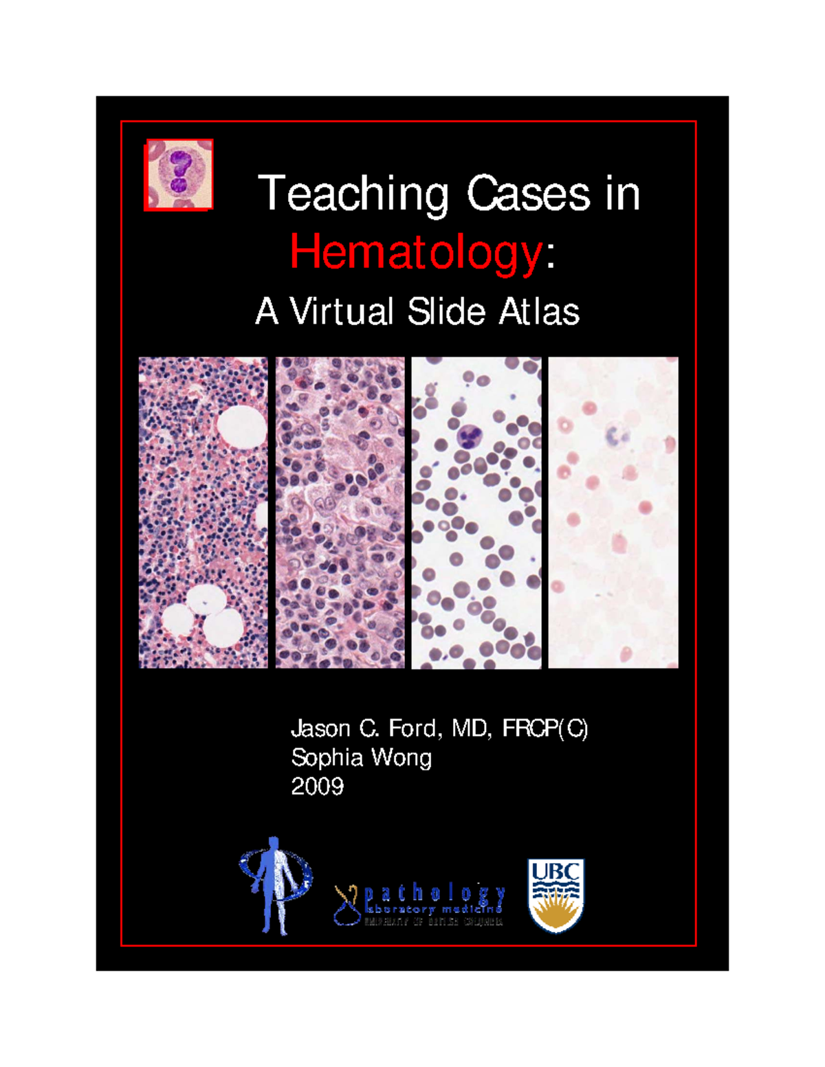 Hematopathology Case Studies Hemepath Cases 1 Review Studocu