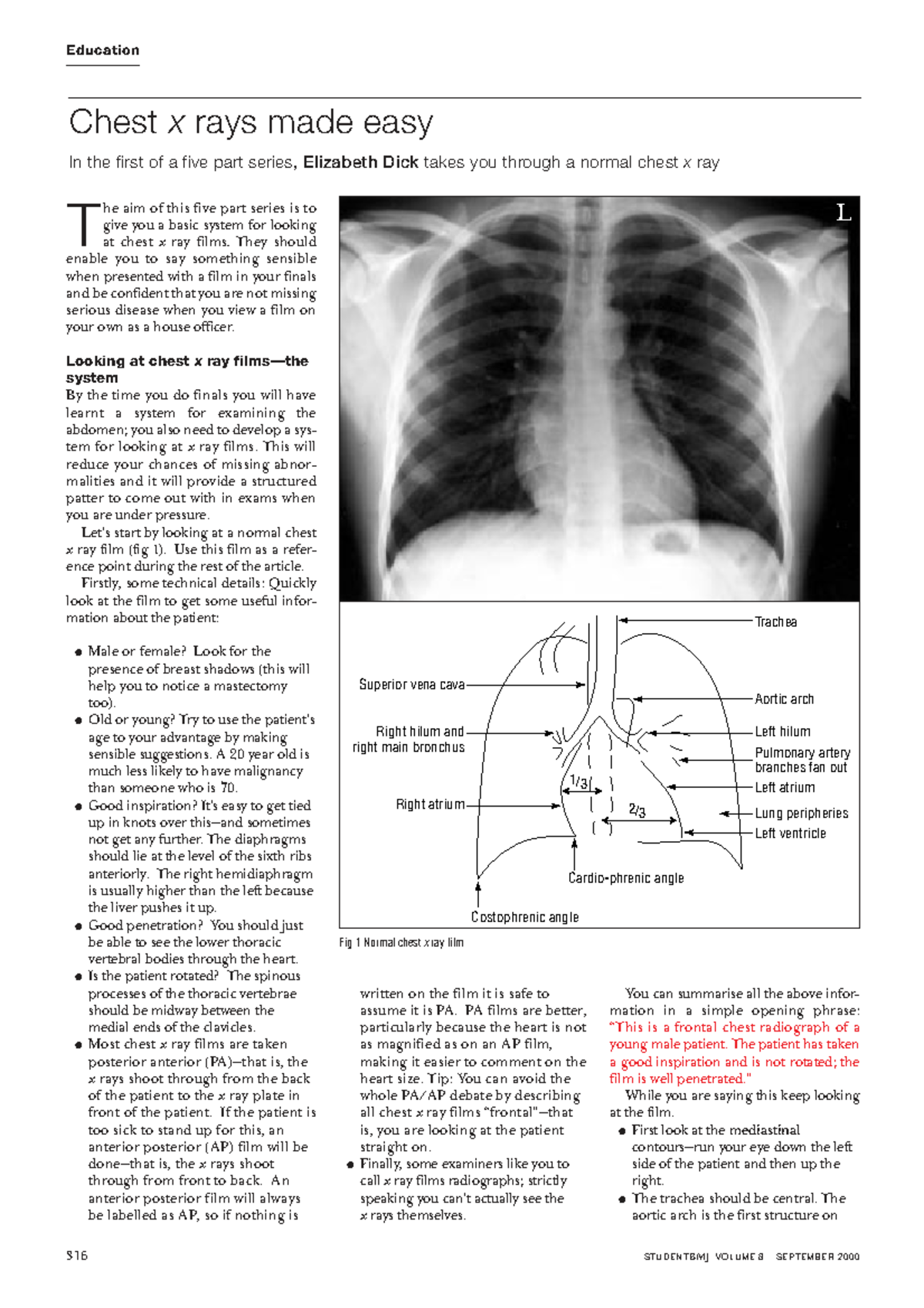 CXR Reading Part 1: A Guide to Normal Chest X-Ray Interpretation - Studocu