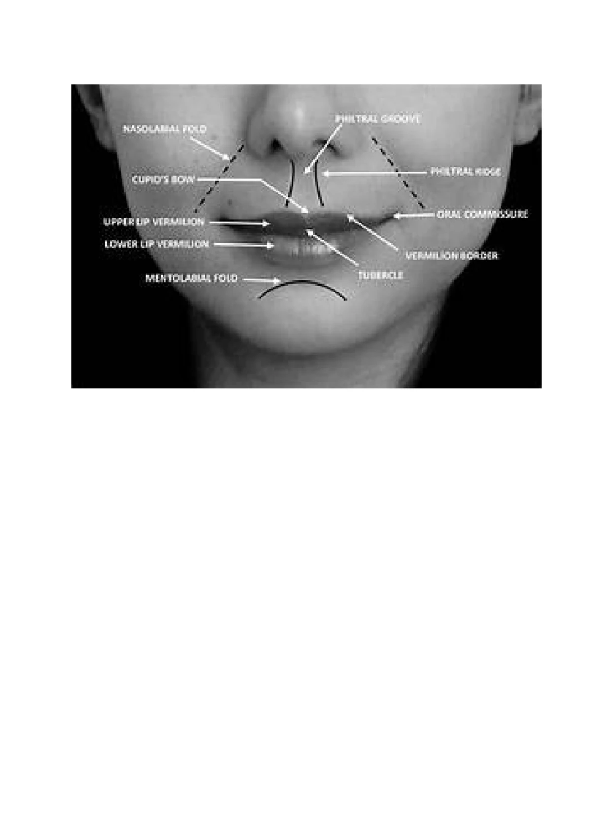 Anatomy of the Tongue: Key Terms and Nerve Supply Overview - Studocu
