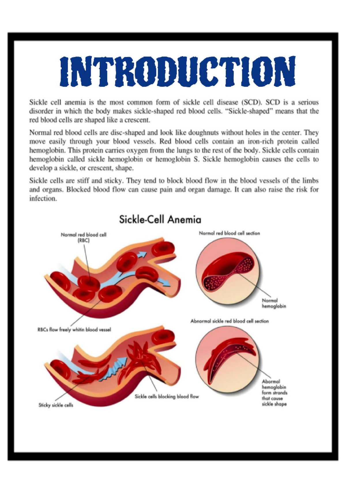 BIO 101: Project on Sickle Cell Anemia - Causes, Complications, and ...