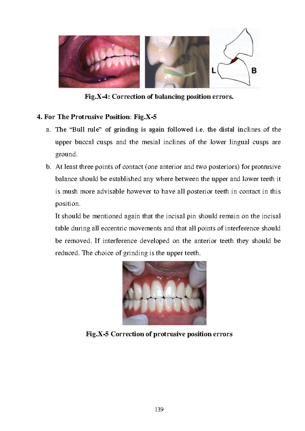 Complete Denture Technology: Techniques & Procedures (29) - Studocu