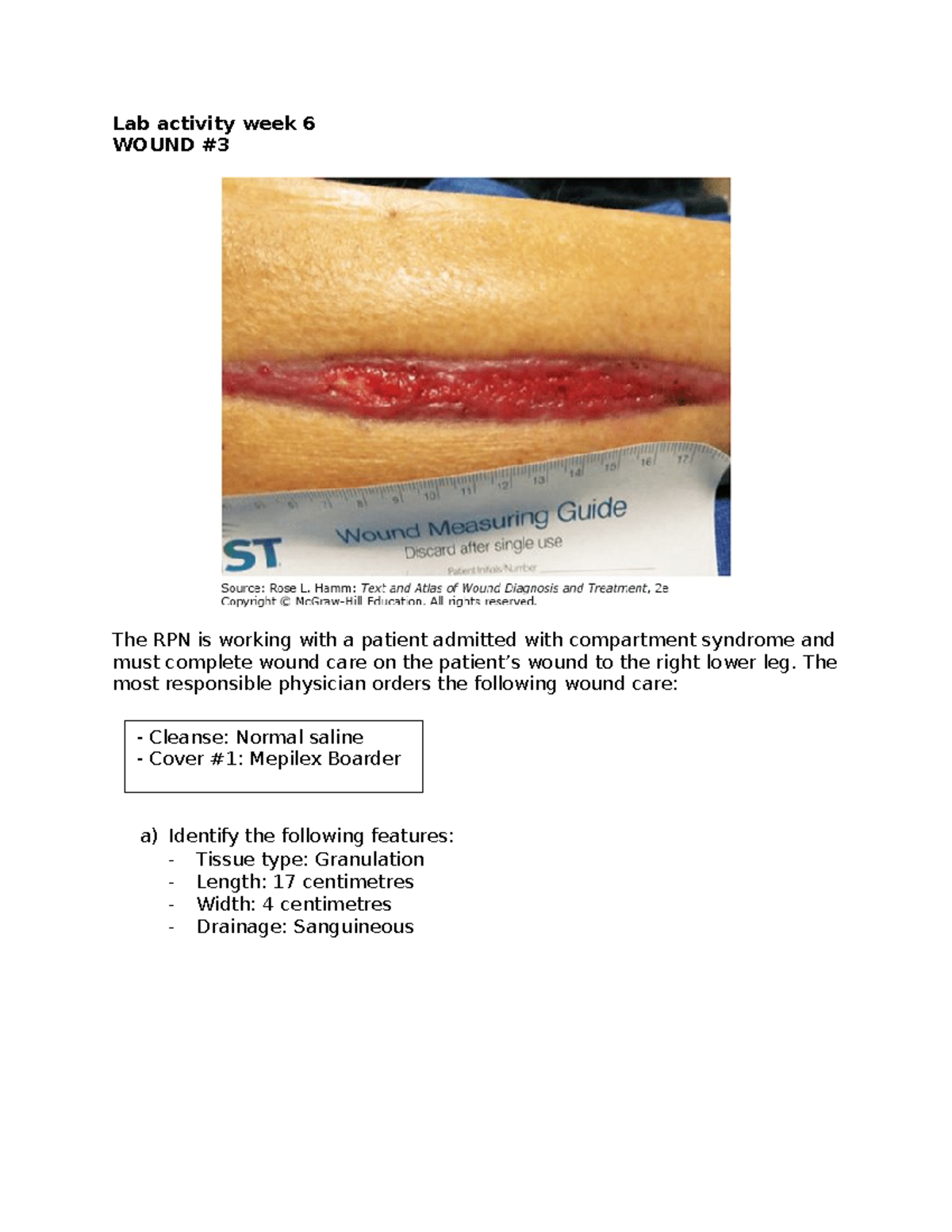 Lab activity week 6 wound 3 - Lab activity week 6 WOUND # The RPN is ...